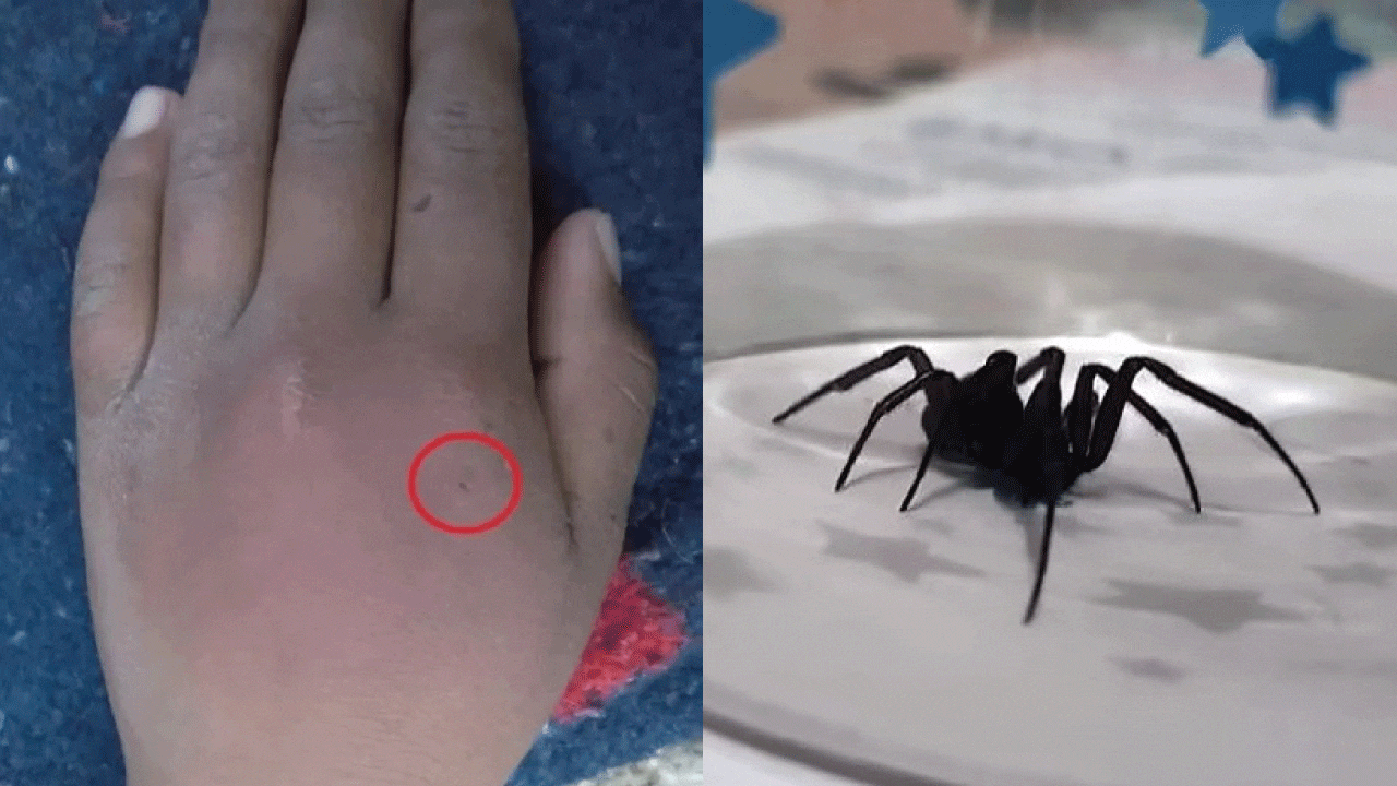 Sanggup biar belakang tapak tangan digigit labah-labah berbisa, ini ...